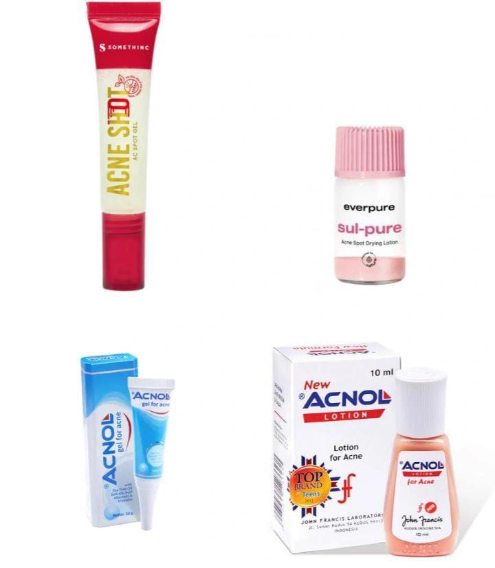 AJAIB! Jerawat Bisa Kempes dalam Sehari, Ini 7 Rekomendasi Obat Totol ...