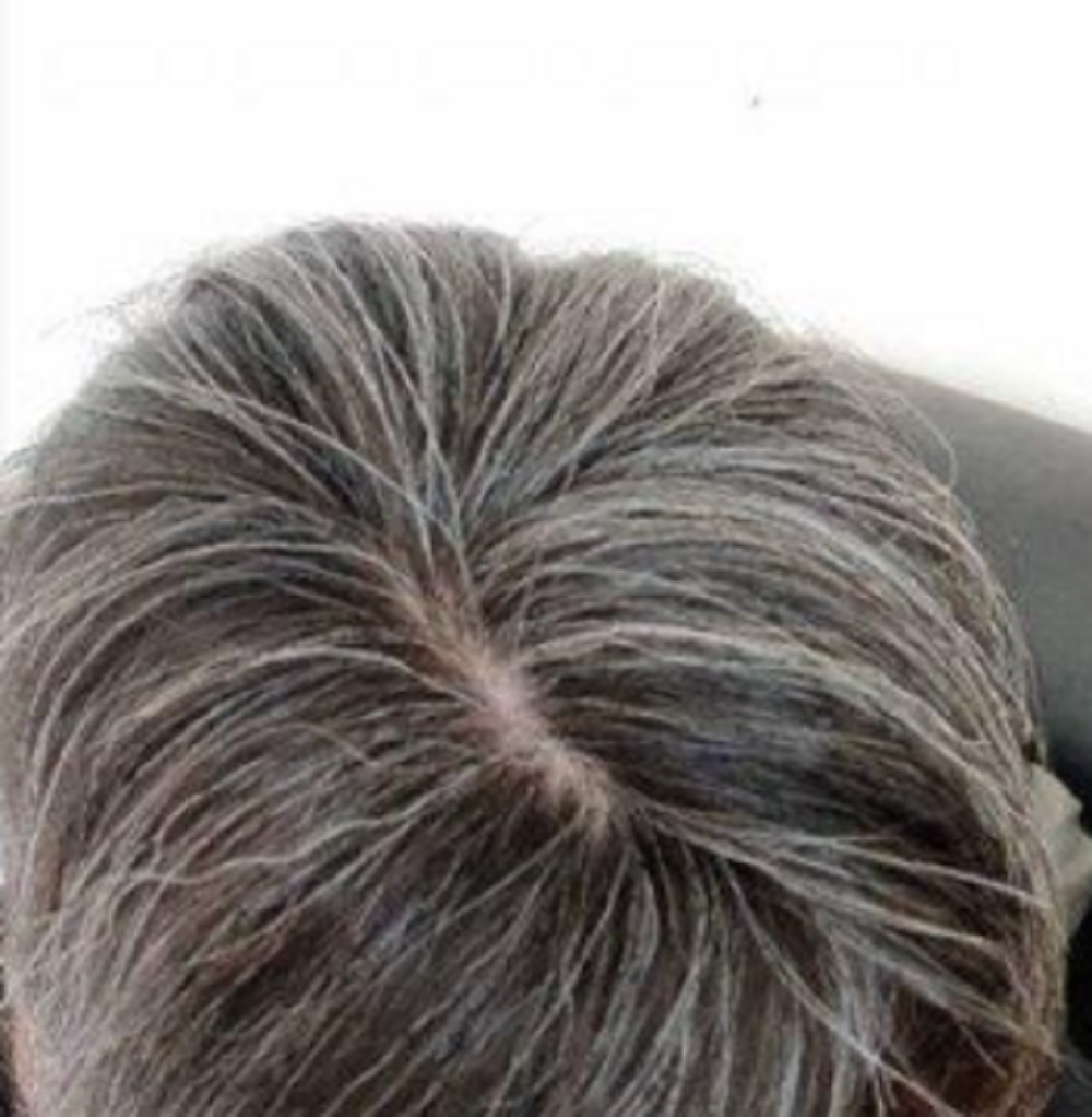 Hukum Menghilangkan Uban dalam Islam, Apa Hukumnya Mencabut Uban? Simak ...