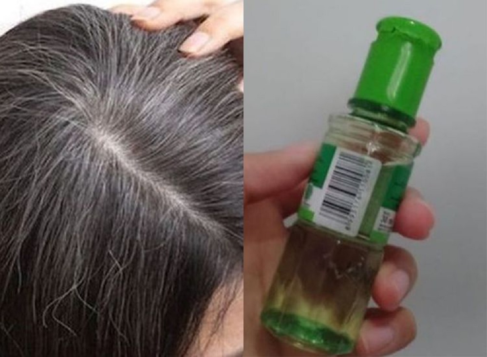 uban hilang dengan minyak kayu putih; INI DIA! cara pakai, campuran dan cara penggunaannya simak ...